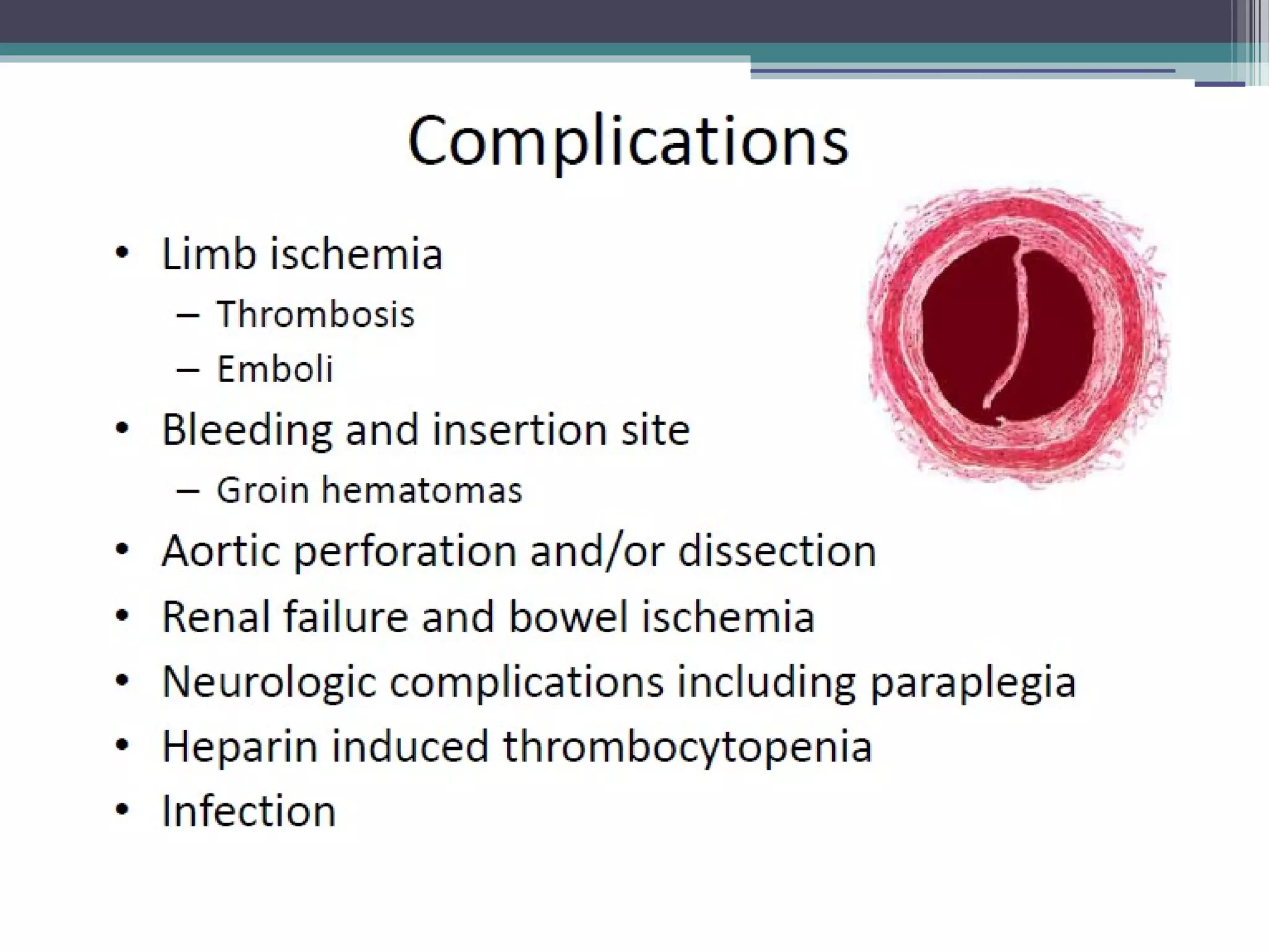 INTRA AORTIC BALLON PUMP (IABP) | PPT
