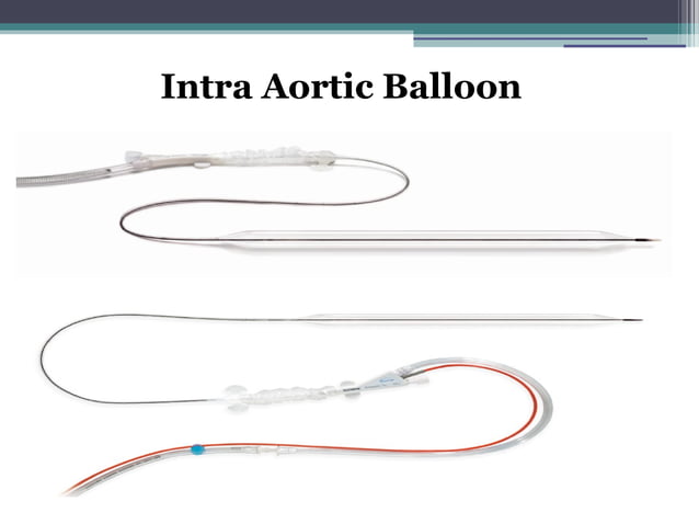 INTRA AORTIC BALLON PUMP (IABP) | PPT