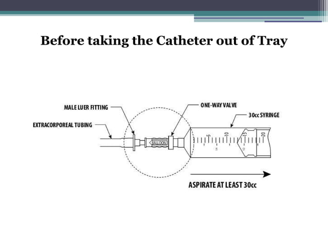 INTRA AORTIC BALLON PUMP (IABP) | PPT