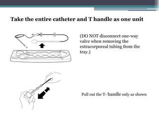INTRA AORTIC BALLON PUMP (IABP) | PPT