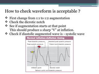 INTRA AORTIC BALLON PUMP (IABP) | PPT