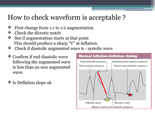 INTRA AORTIC BALLON PUMP (IABP) | PPT