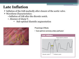 INTRA AORTIC BALLON PUMP (IABP) | PPT