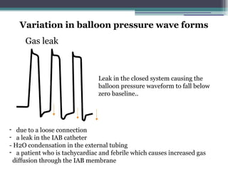 INTRA AORTIC BALLON PUMP (IABP) | PPT