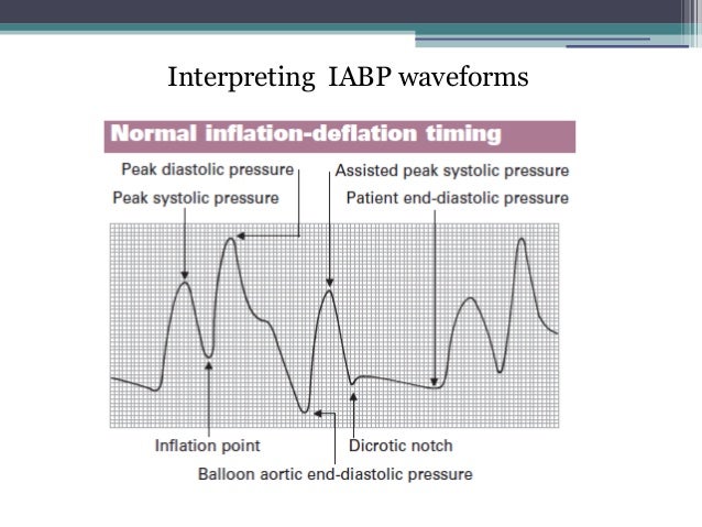 INTRA AORTIC BALLON PUMP (IABP)