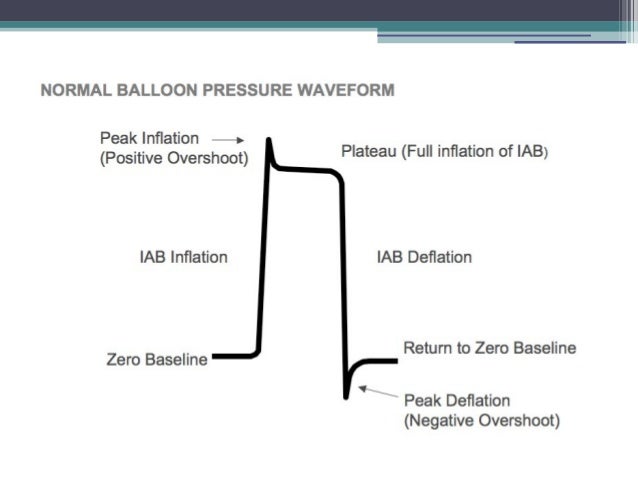 INTRA AORTIC BALLON PUMP (IABP)