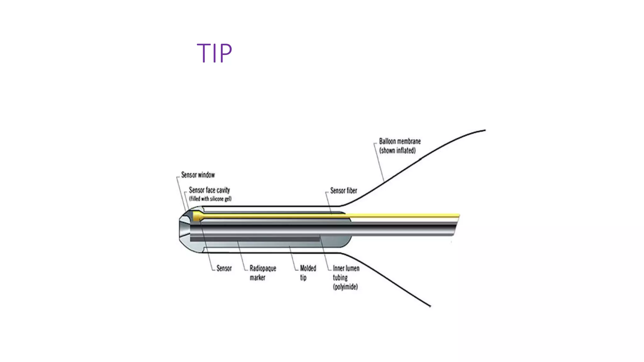 IABP troubleshooting | PPTX