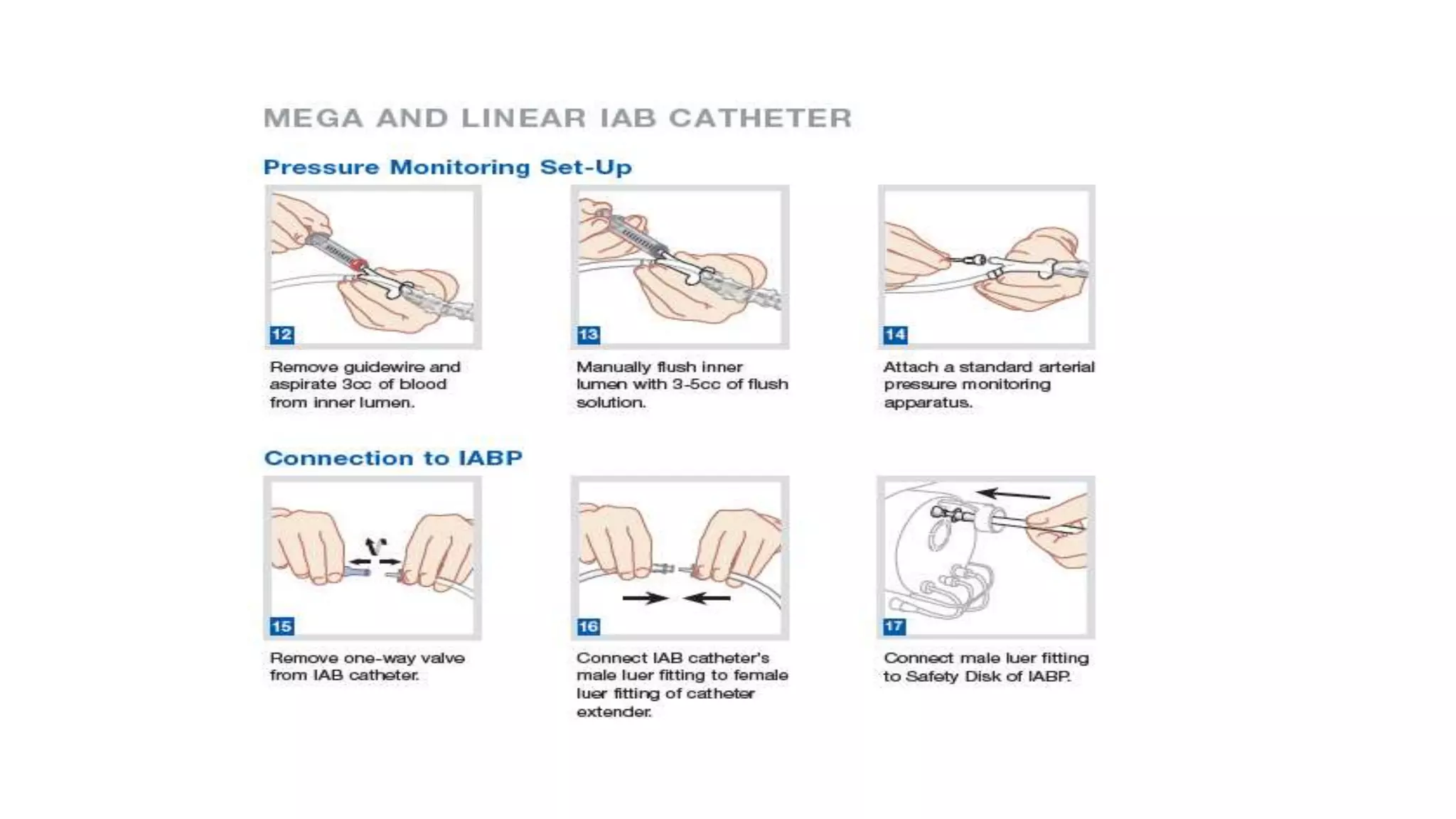 IABP troubleshooting | PPTX
