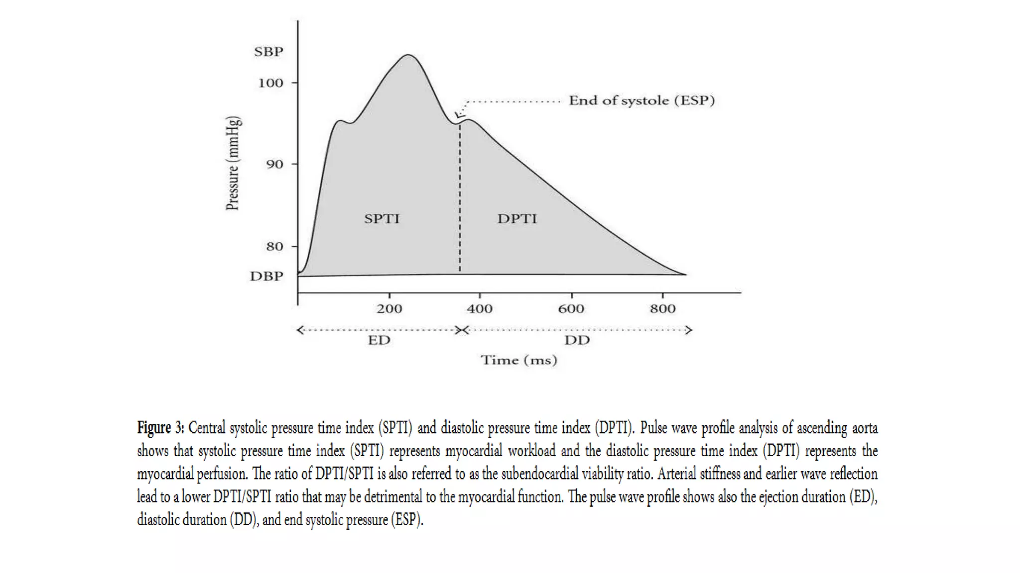IABP troubleshooting | PPTX