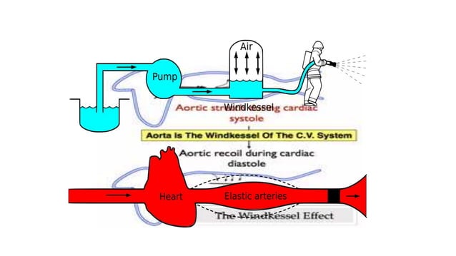 IABP troubleshooting | PPTX | Heart and Cardiovascular Diseases ...