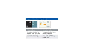 IABP troubleshooting | PPTX