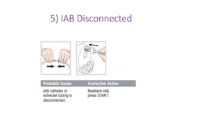 IABP troubleshooting | PPTX
