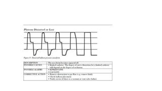 IABP troubleshooting | PPTX
