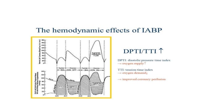 IABP troubleshooting | PPTX | Heart and Cardiovascular Diseases ...