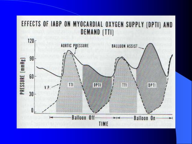 Iabp | PPT | First Aid | Injuries