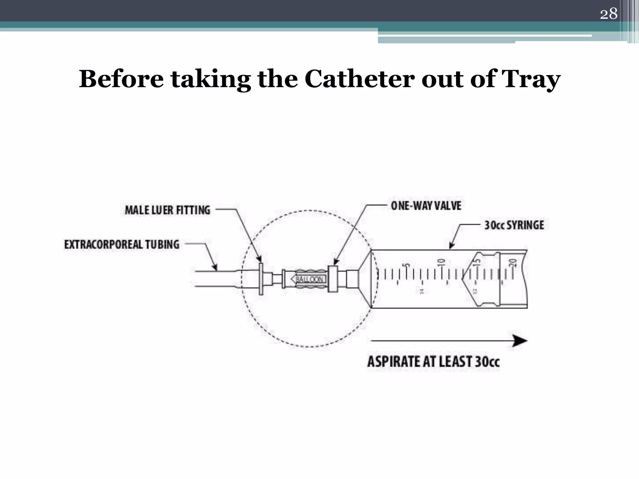 Iabp instrumentation, indications and complications | PPTX