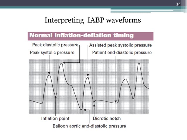 Iabp instrumentation, indications and complications | PPTX