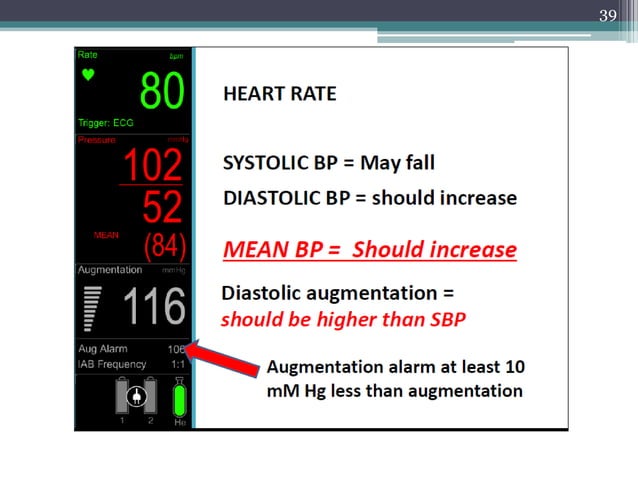Iabp instrumentation, indications and complications | PPTX