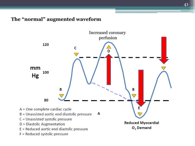 Iabp instrumentation, indications and complications | PPTX
