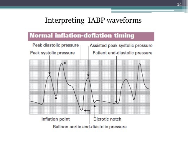 Iabp instrumentation, indications and complications