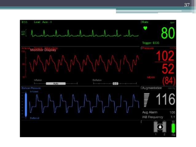 Iabp instrumentation, indications and complications