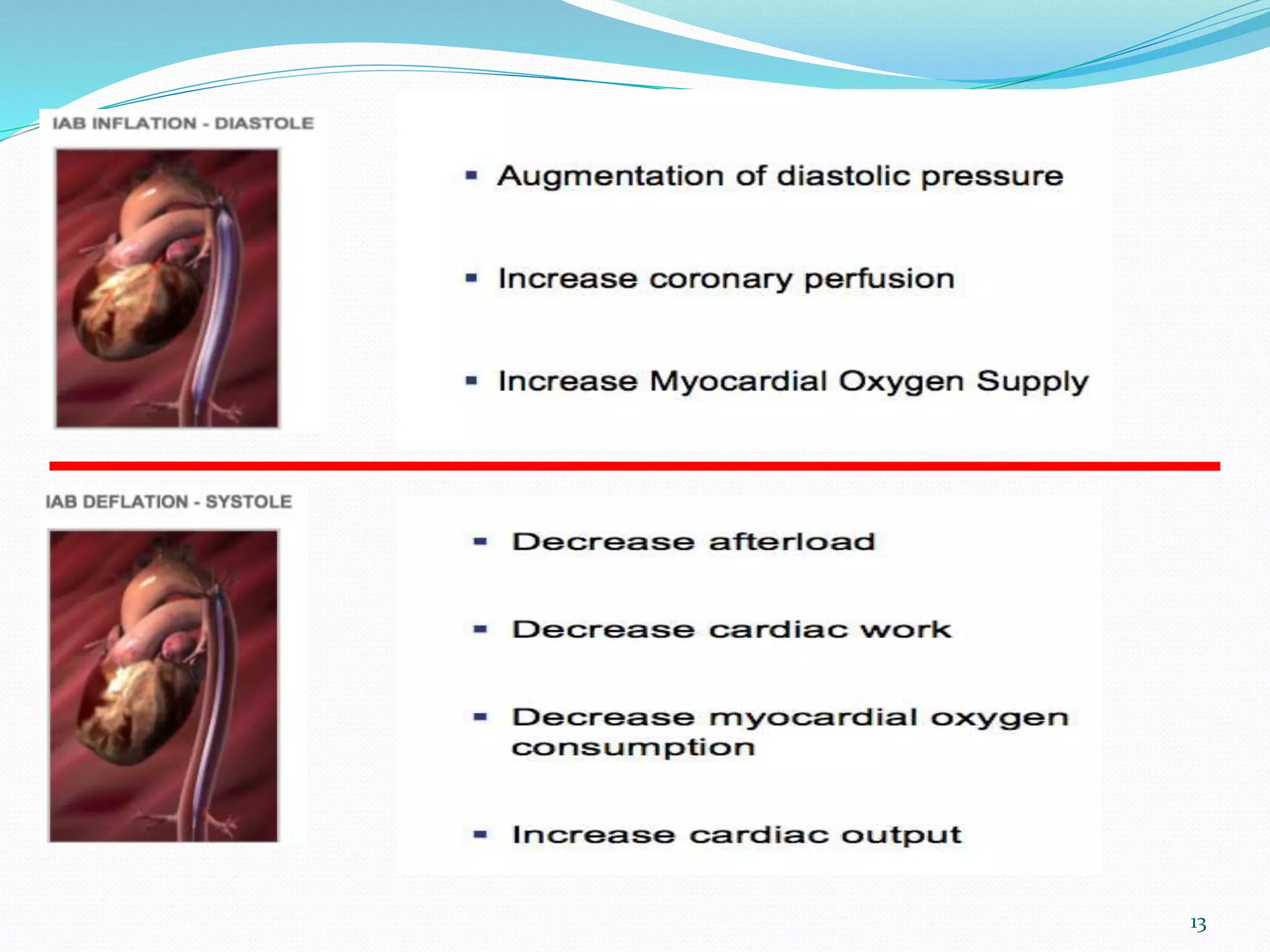 Iabp instrumentation, indications and complications | PPT