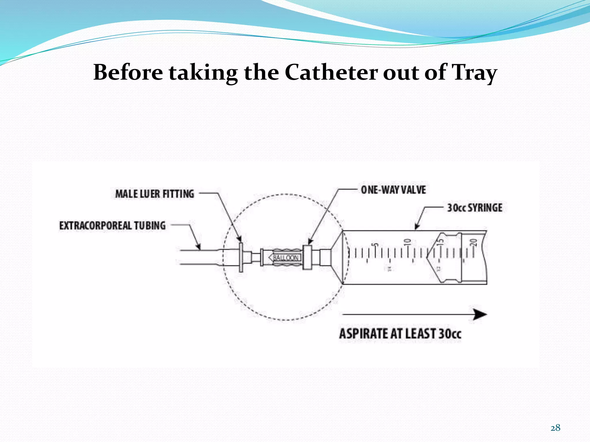 Iabp instrumentation, indications and complications | PPT