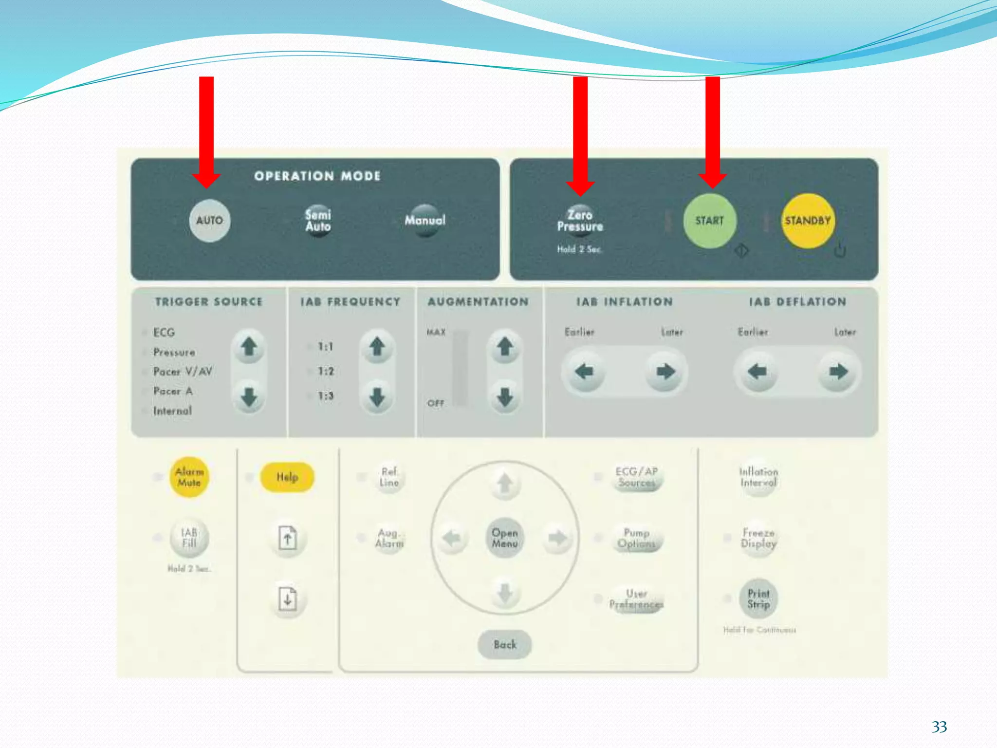 Iabp instrumentation, indications and complications | PPT
