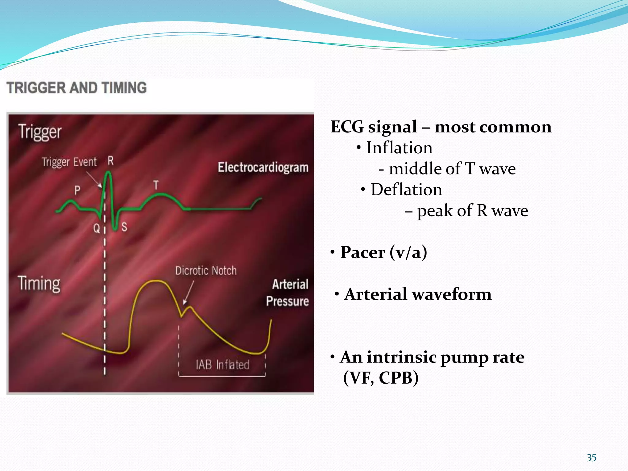 Iabp instrumentation, indications and complications | PPT
