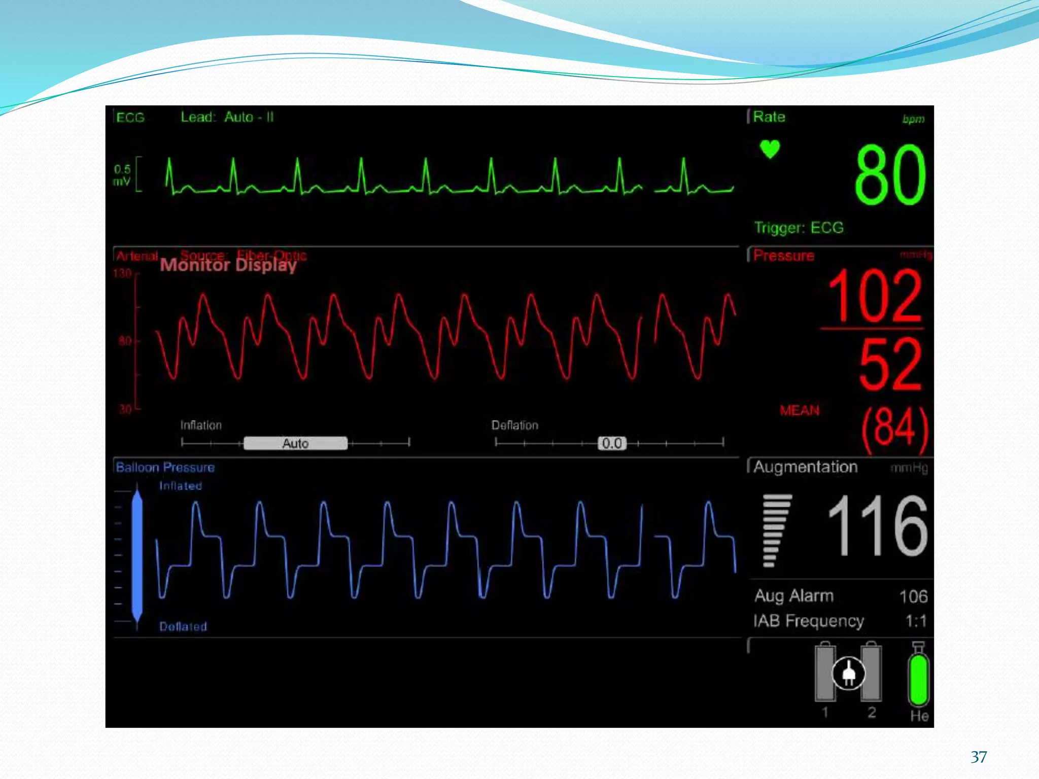 Iabp instrumentation, indications and complications | PPT
