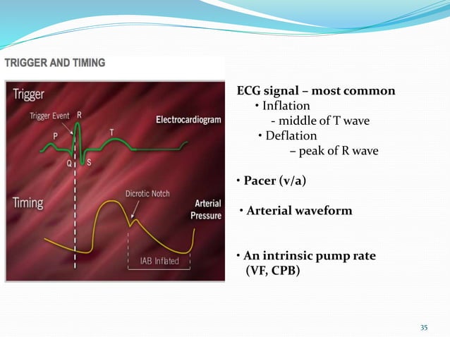 Iabp instrumentation, indications and complications | PPT
