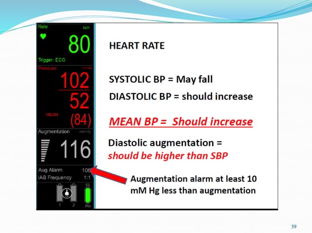 Iabp instrumentation, indications and complications | PPT