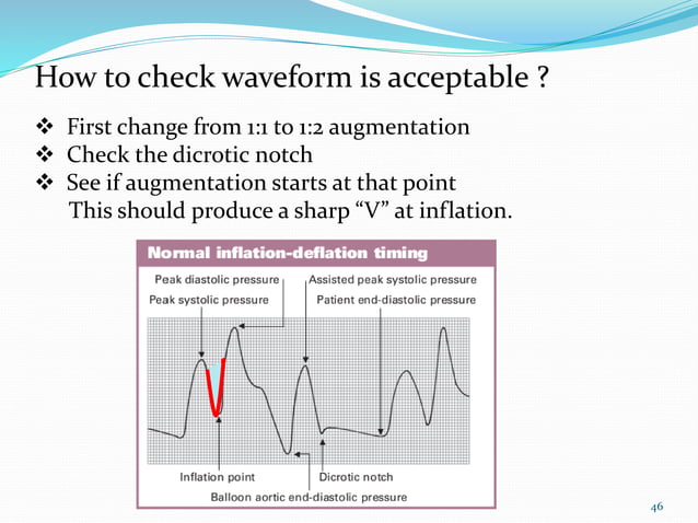 Iabp instrumentation, indications and complications | PPT