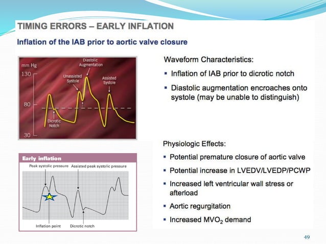 Iabp instrumentation, indications and complications | PPT