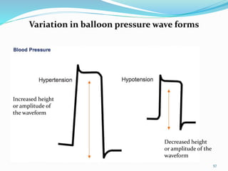 Iabp instrumentation, indications and complications | PPTX
