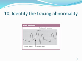Iabp instrumentation, indications and complications | PPTX