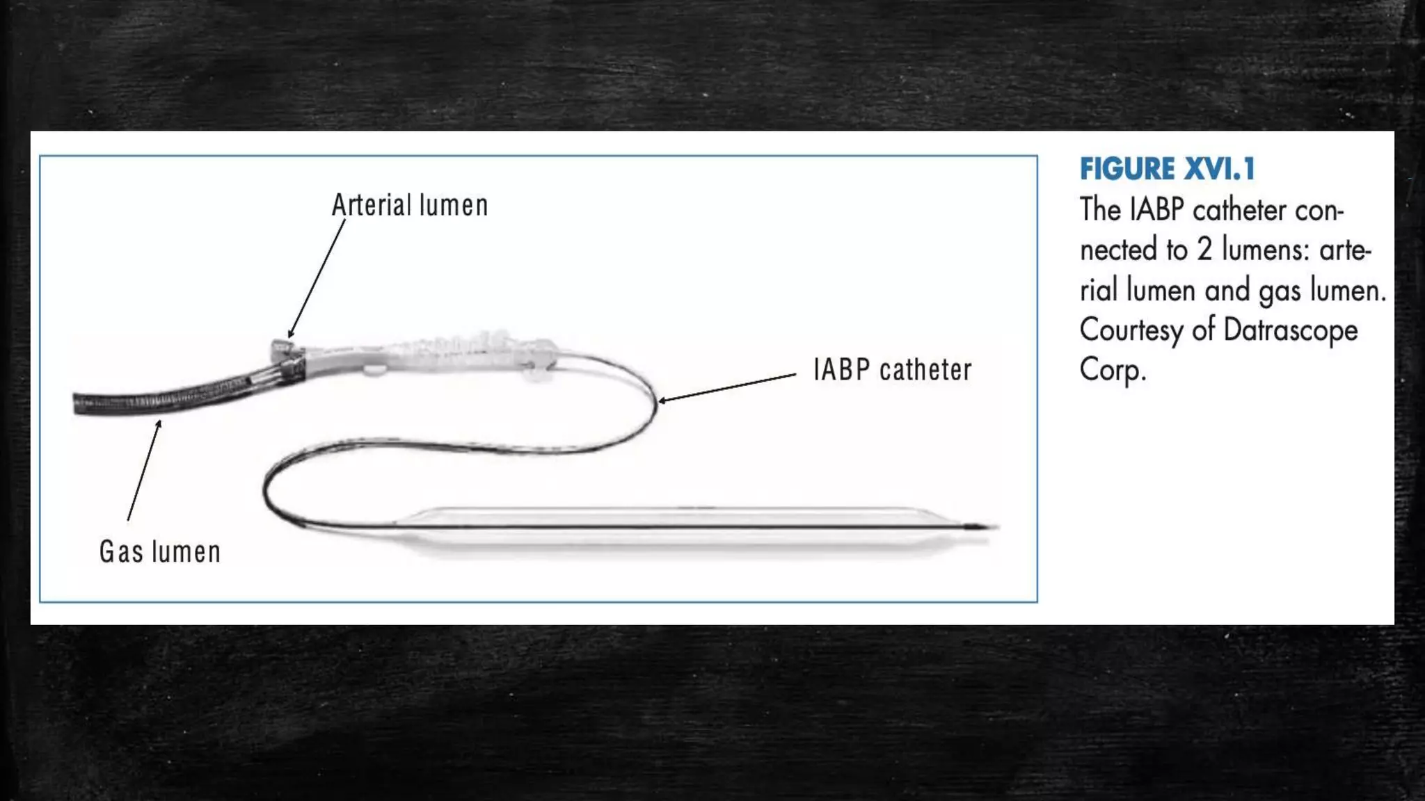 Overview of Intra-Aortic Balloon Pump (IABP) | PPTX