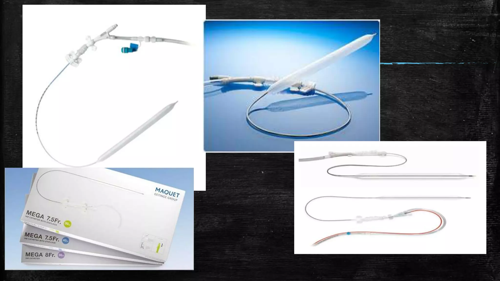 Overview of Intra-Aortic Balloon Pump (IABP) | PPTX