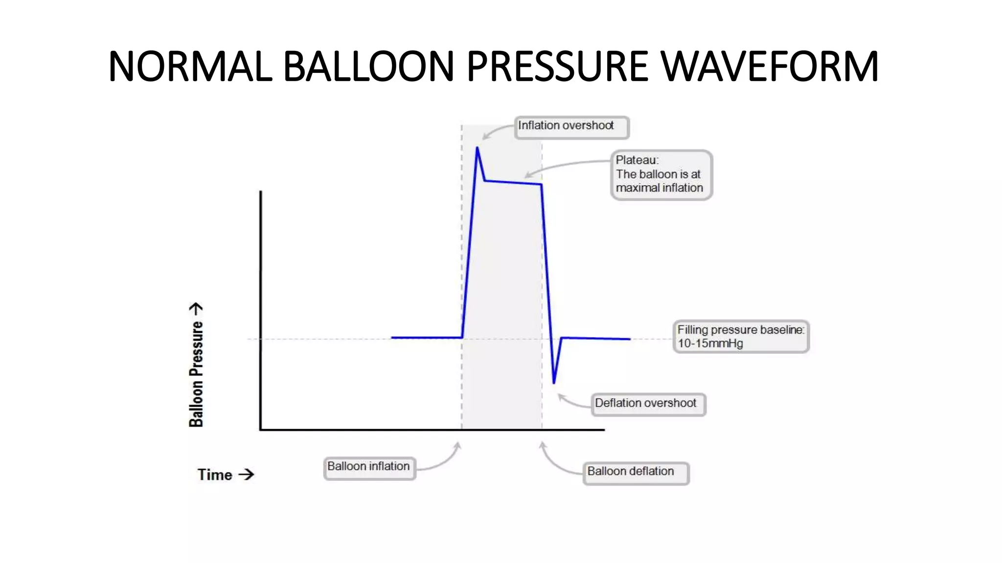 Iabp presentation | PPTX