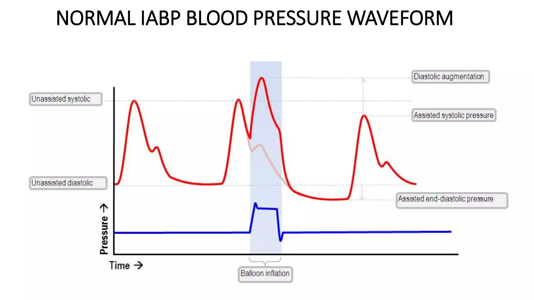 Iabp presentation | PPTX