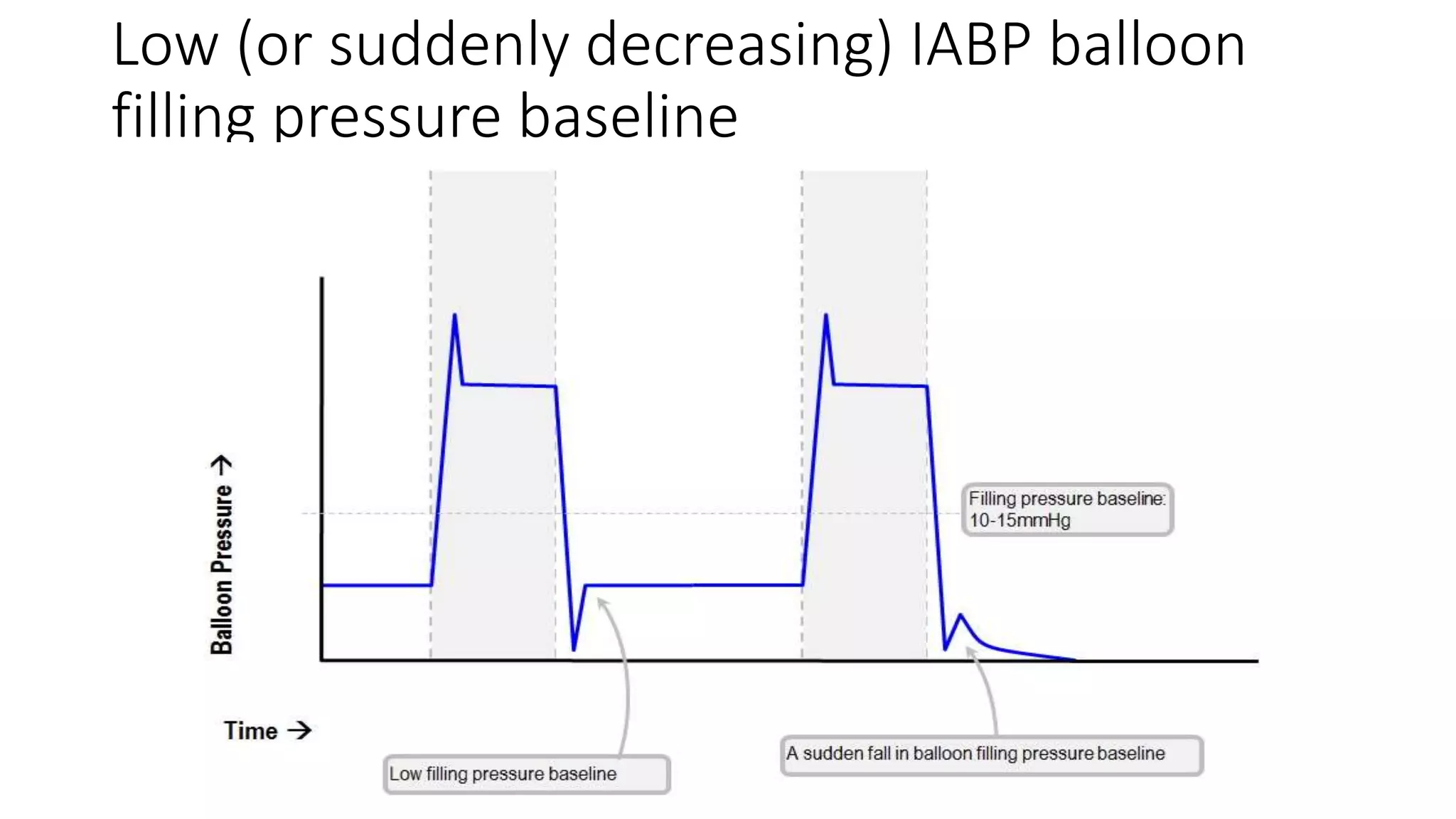 Iabp presentation | PPTX