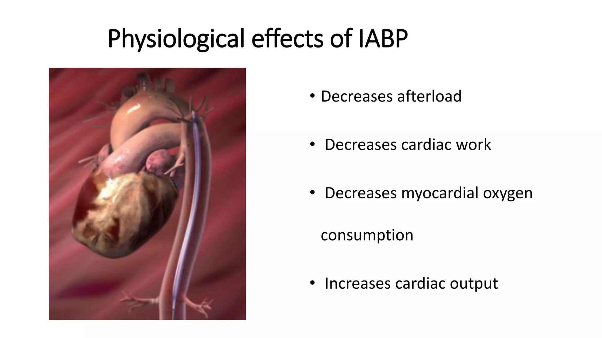 Iabp presentation | PPTX