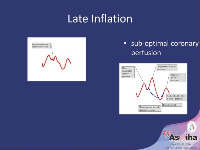 Iabp principle, hemodynamic, timing, weaning 2016 background asmiha ...