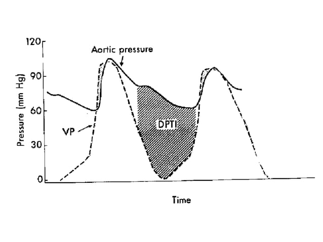 Iabp principle, hemodynamic, timing, weaning 2016 background asmiha ...