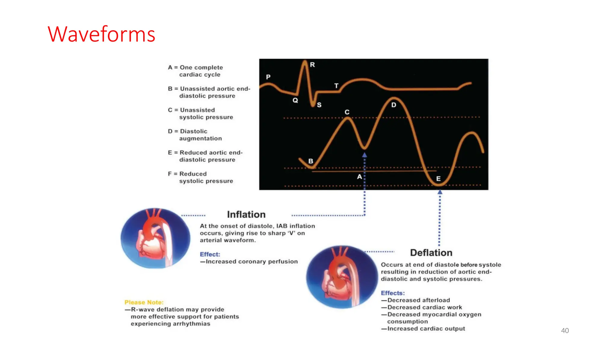 INTRA AORTIC BALLOON PUMP ............................ | PPTX