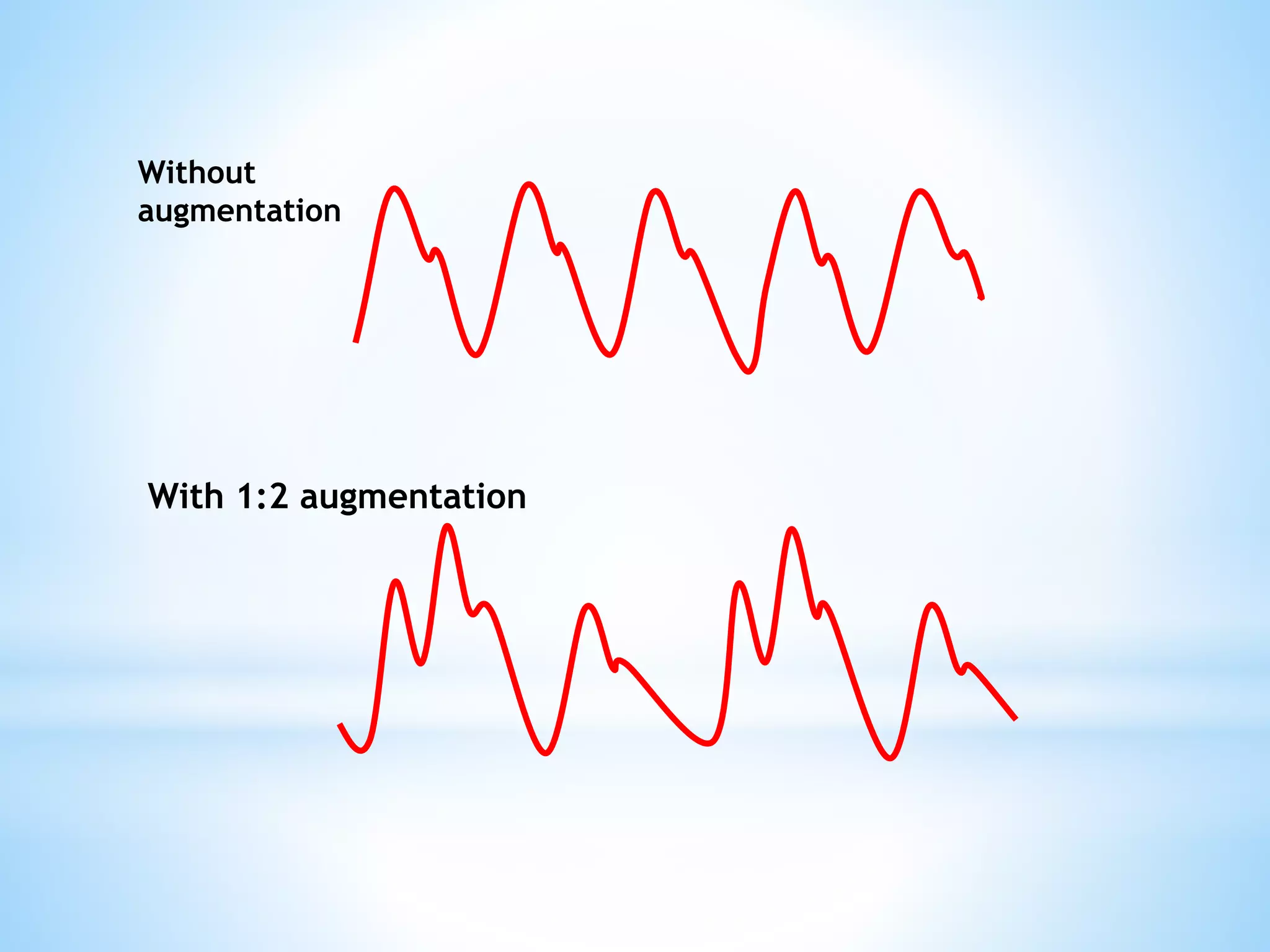 Iabp wave forms | PPTX