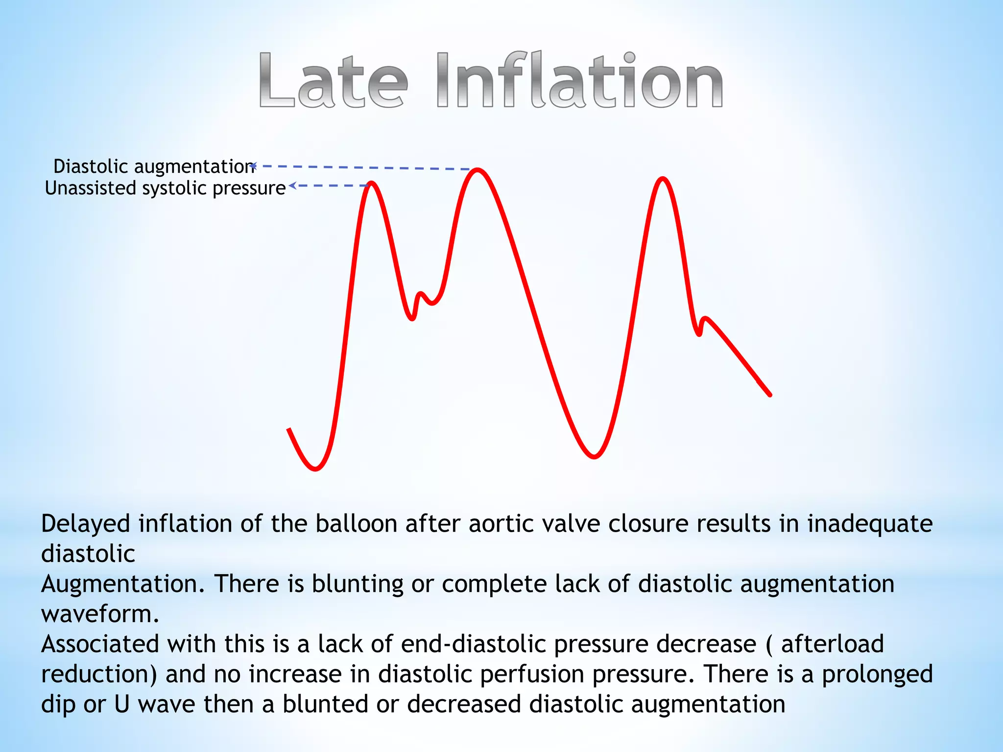 Iabp wave forms | PPTX