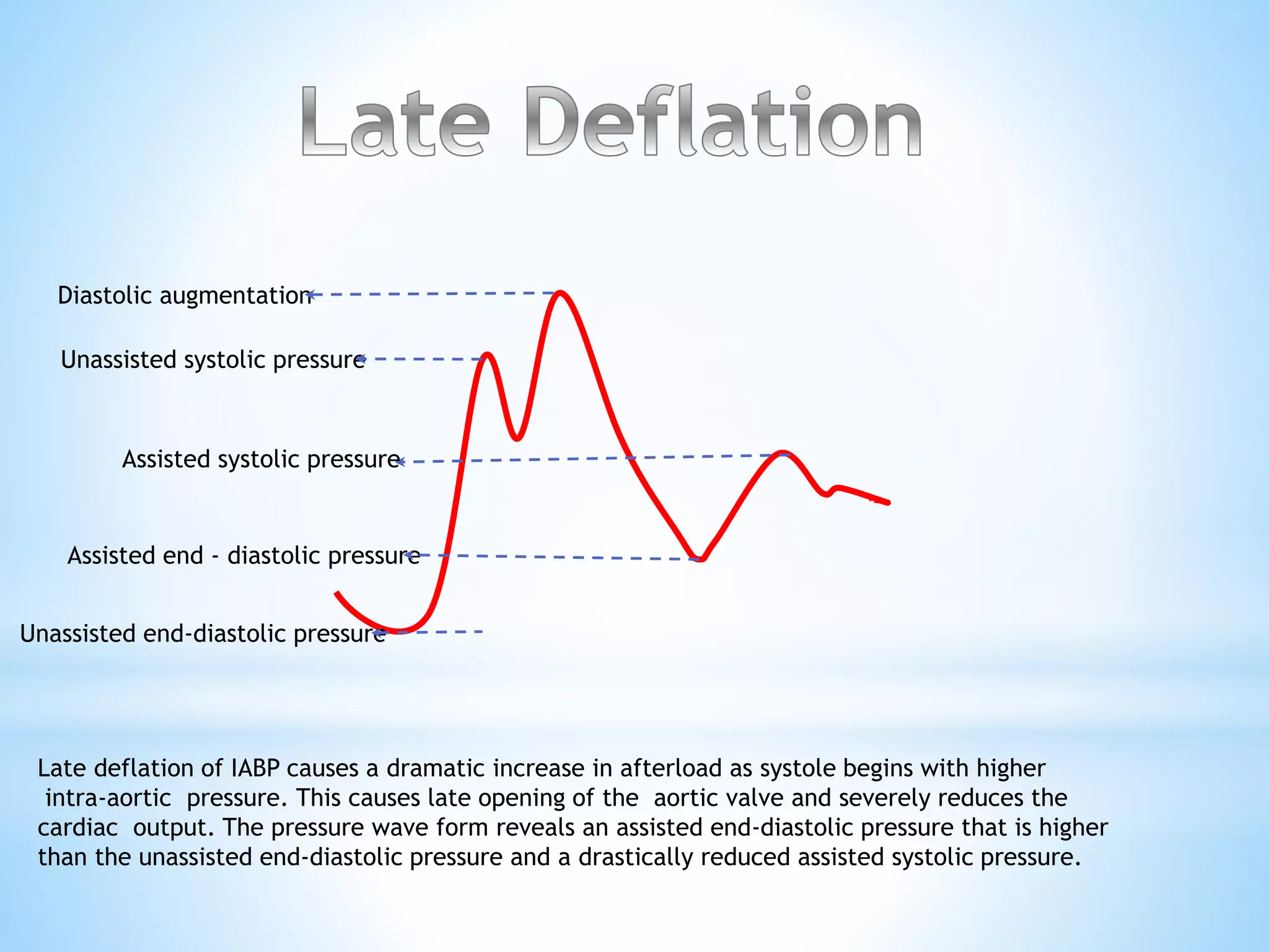 Iabp wave forms | PPTX