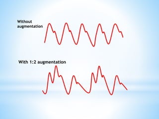 Iabp wave forms | PPTX
