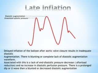 Iabp wave forms | PPTX